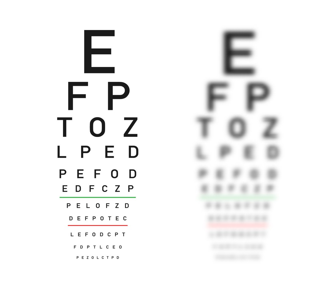 Glossary of Eye Terms | ICON Eyecare Grand Junction