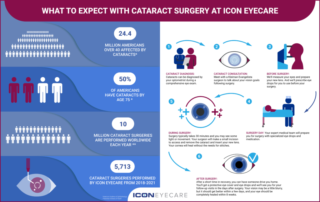 What to Expect with Cataract Surgery: Before, During and After - LASIK ...